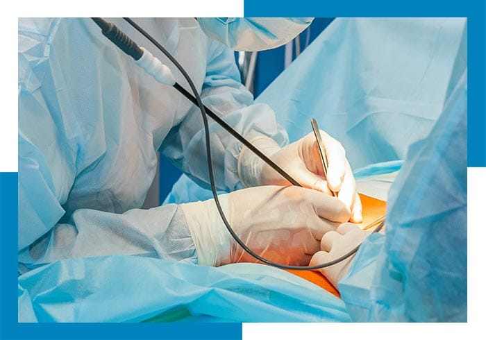 Peritoneal Surgery – HIPEC from The Bowel Cancer Clinic